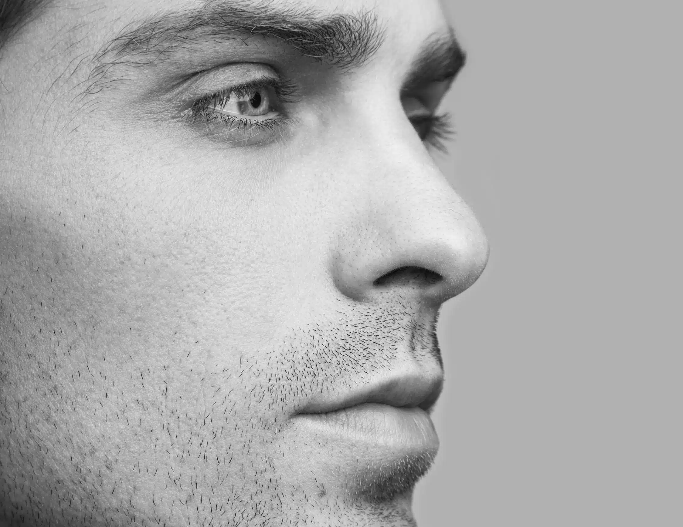 Epilation Laser des Pommettes, à Suresnes - Tarif | CLEM, Centre Esthétique